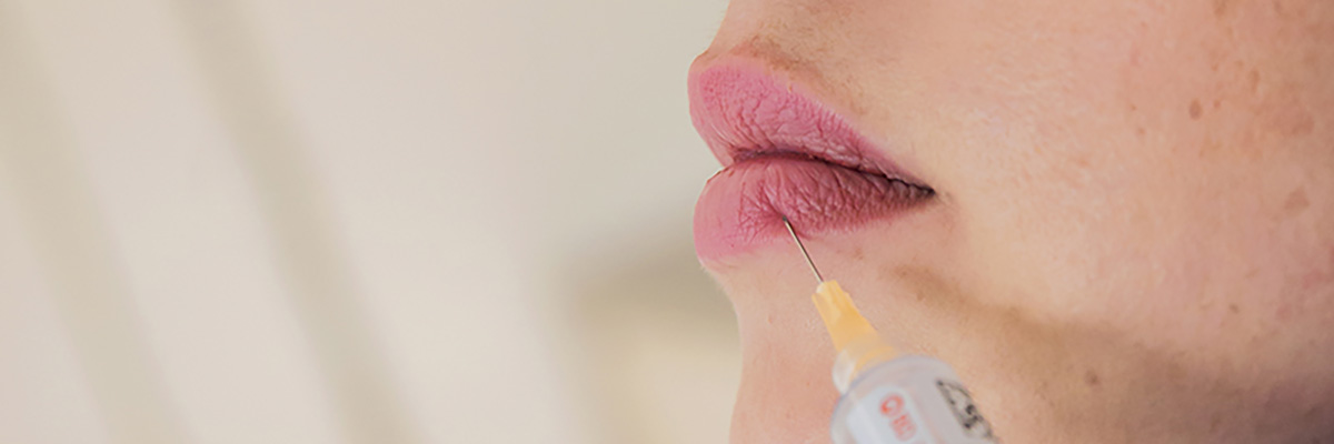 Acide hyaluronique - Neuf institut